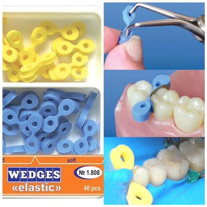 Elastic Fixing Matrix Sectional Interdental Wedges - Wali Dental Supply