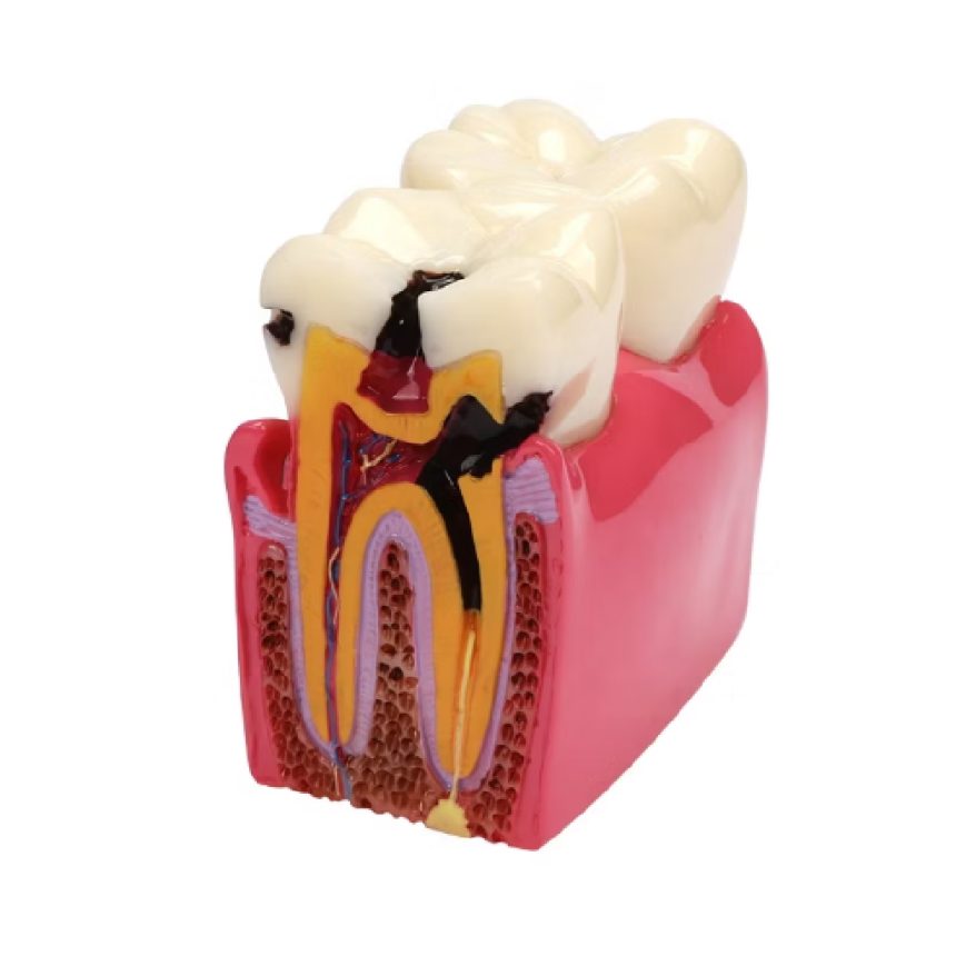 Study modal plastic periodontal teeth - Wali Dental Supply